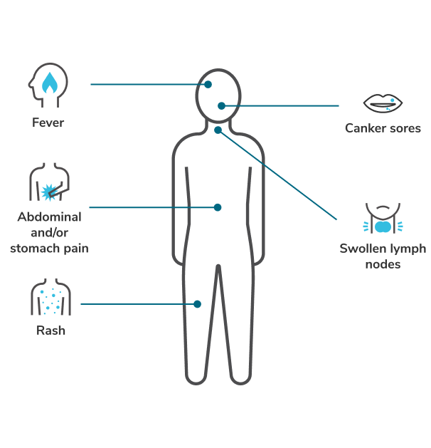 Signs & Symptoms of HIDS/MKD